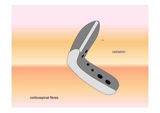 Internal Capsule.pdf