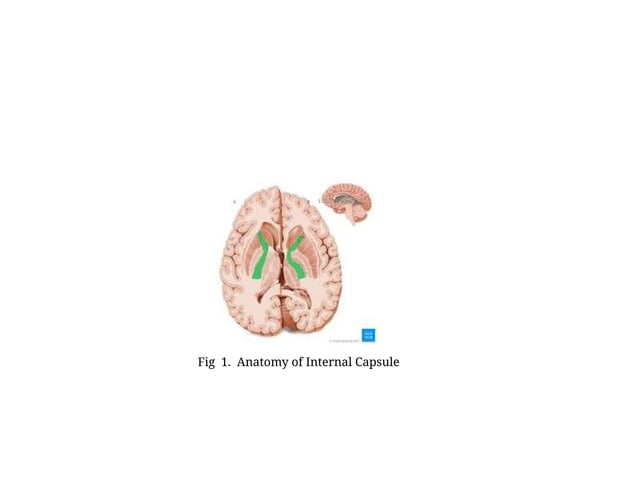 Internal Capsule_Divisions_fibres_lesions | PPTX
