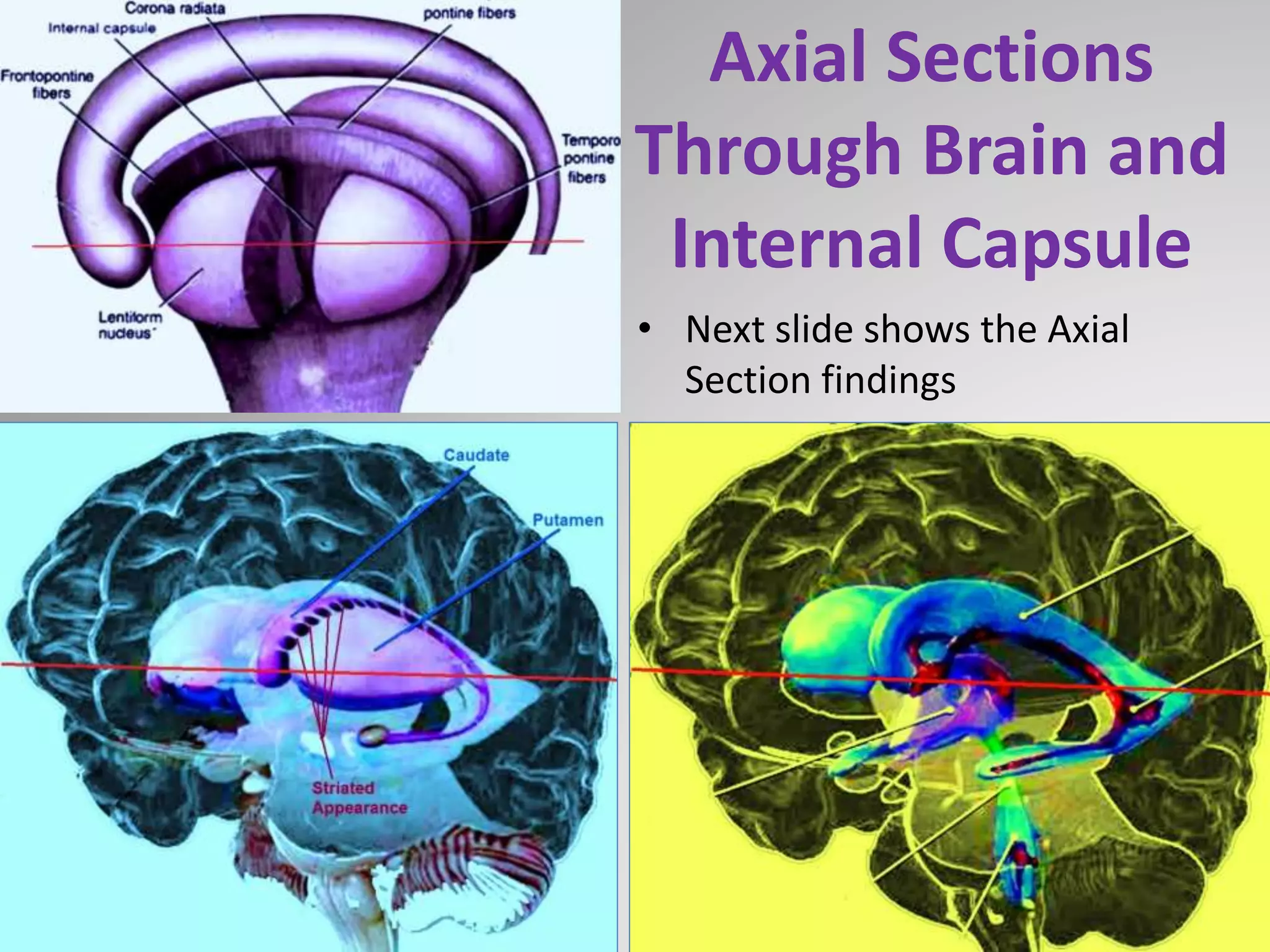 Brain Internal Capsule – Structure Orientation Tracts - Sanjoy Sanyal ...