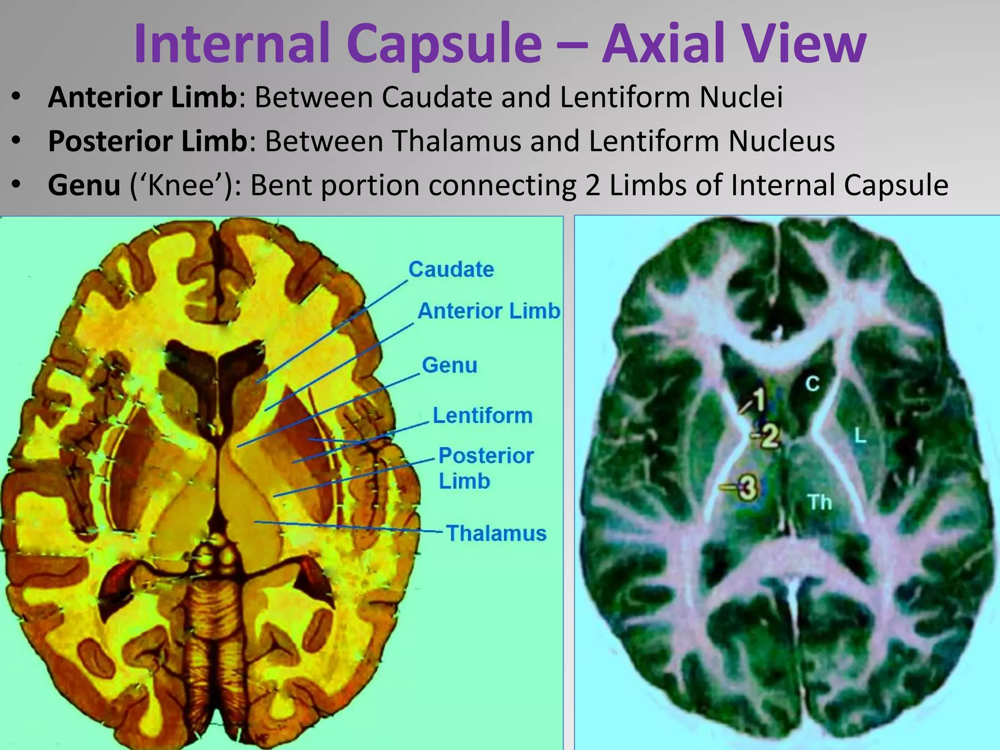 Brain Internal Capsule – Structure Orientation Tracts - Sanjoy Sanyal ...