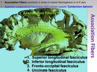 Brain Internal Capsule – Structure Orientation Tracts - Sanjoy Sanyal ...