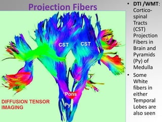 Brain Internal Capsule – Structure Orientation Tracts - Sanjoy Sanyal ...