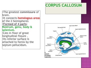 internal capsule white matter of cerebrum.pptx