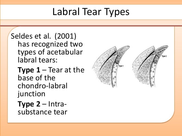Internal causes of hip pain - Itamar Botser, MD