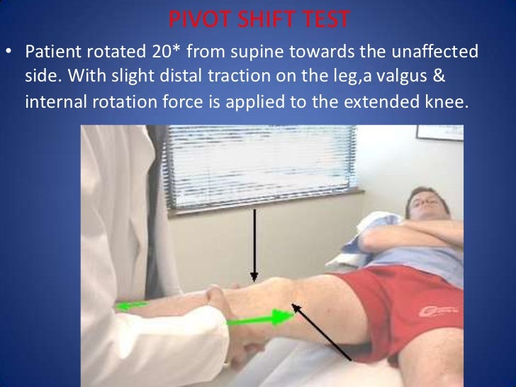 derangement knee ppt