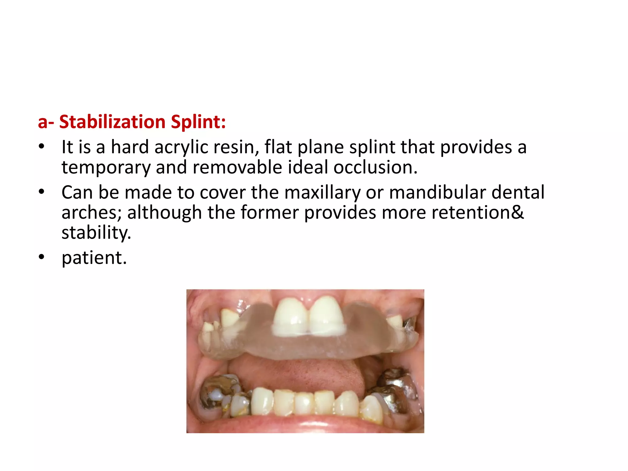 Internal derangement of tmj | PDF