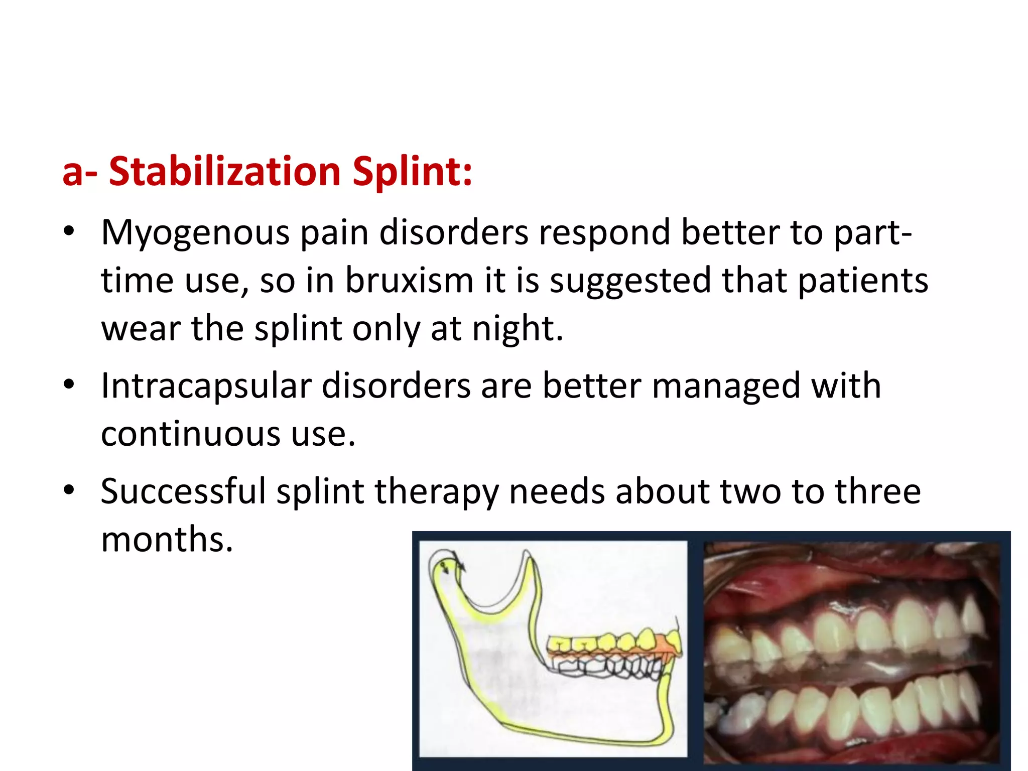 Internal derangement of tmj | PDF