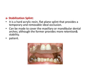 Internal derangement of tmj | PDF