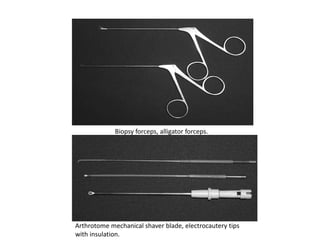 Internal derangement of tmj | PDF