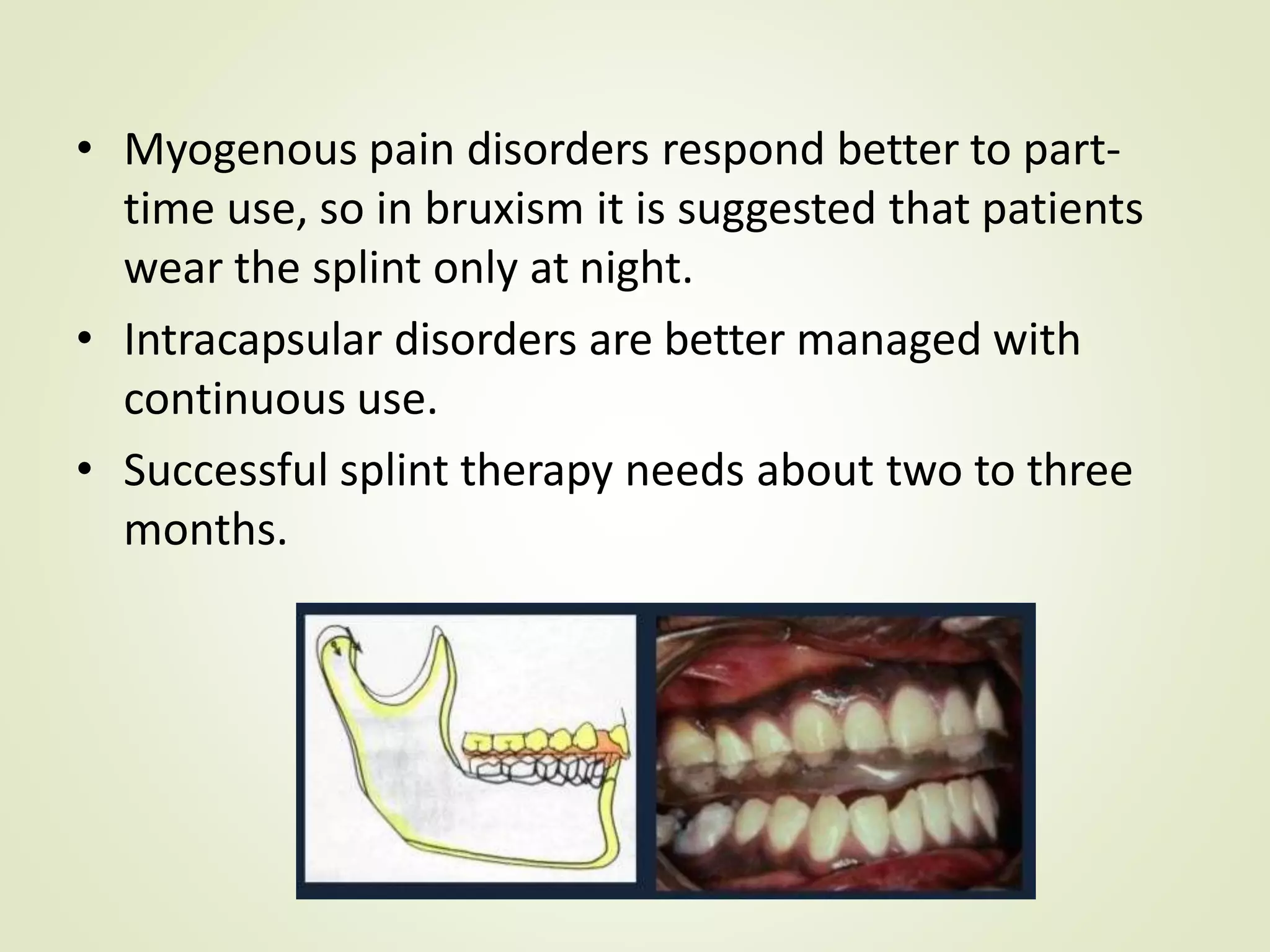 Internal derangement of TMJ | PPTX