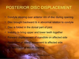 Internal disk derangement/ dental crown & bridge courses | PPT