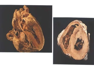 Internal features of the heart | PPTX
