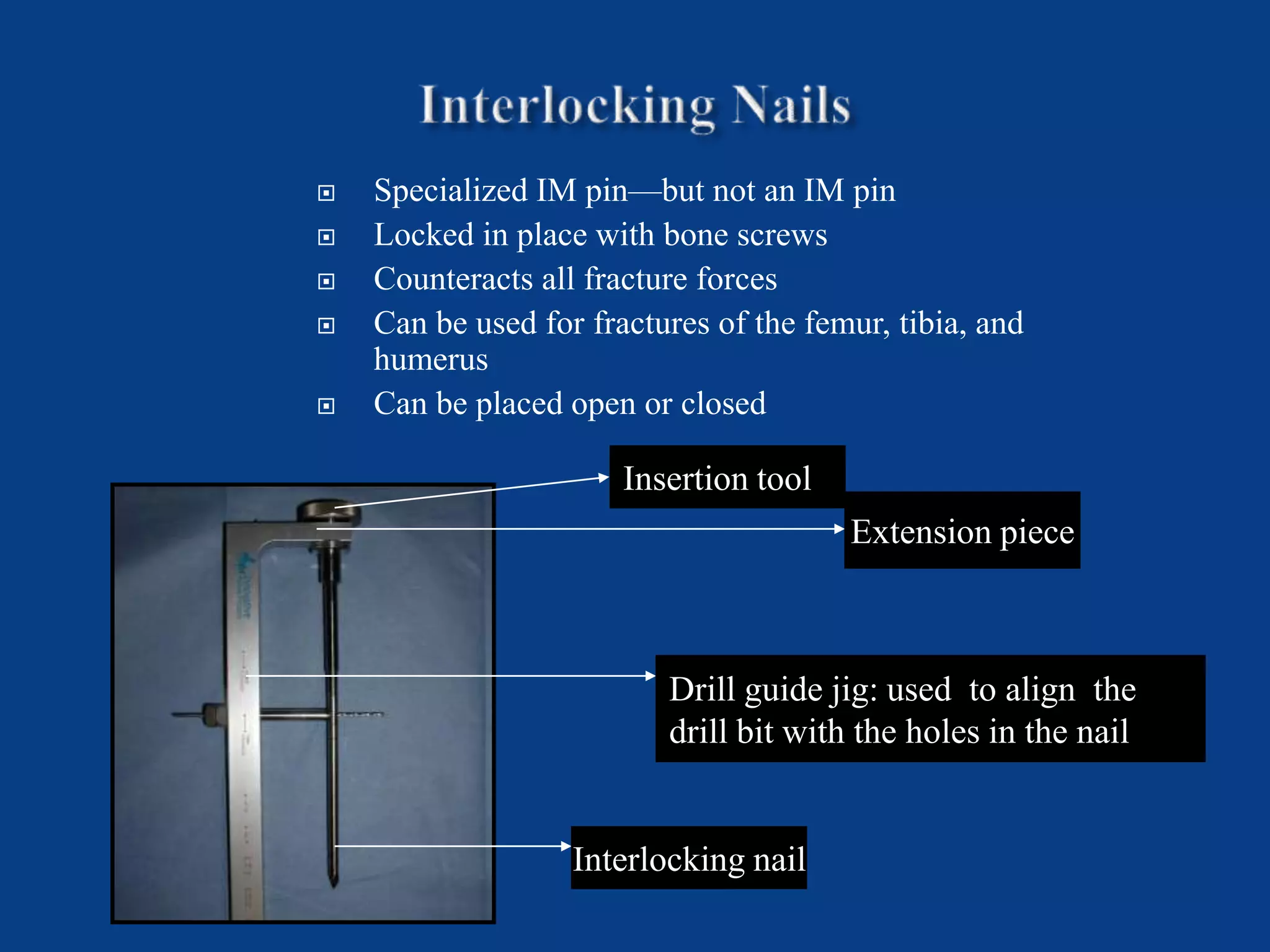 Internal fixation techniques | PPTX