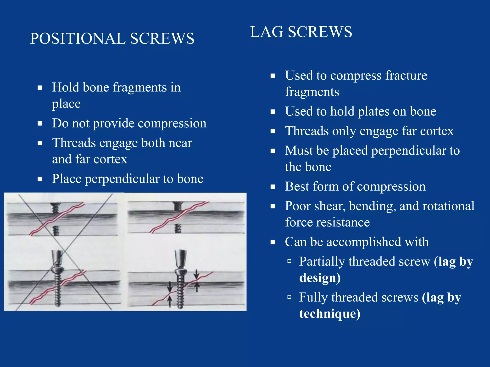 Internal fixation techniques | PPTX