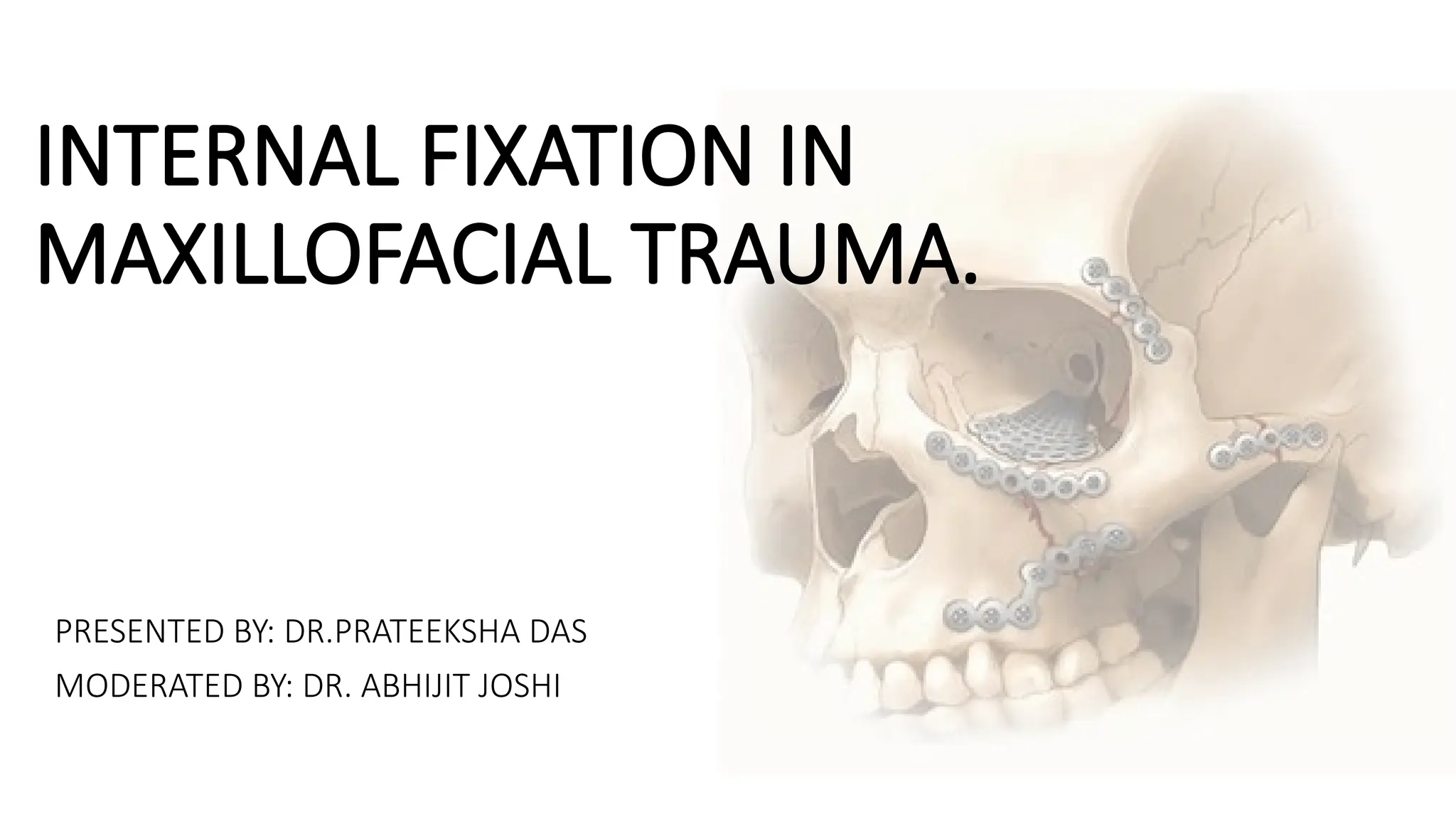 INTERNAL FIXATION IN MAXILLOFACIAL TRAUMA- PART A [Autosaved].pptx