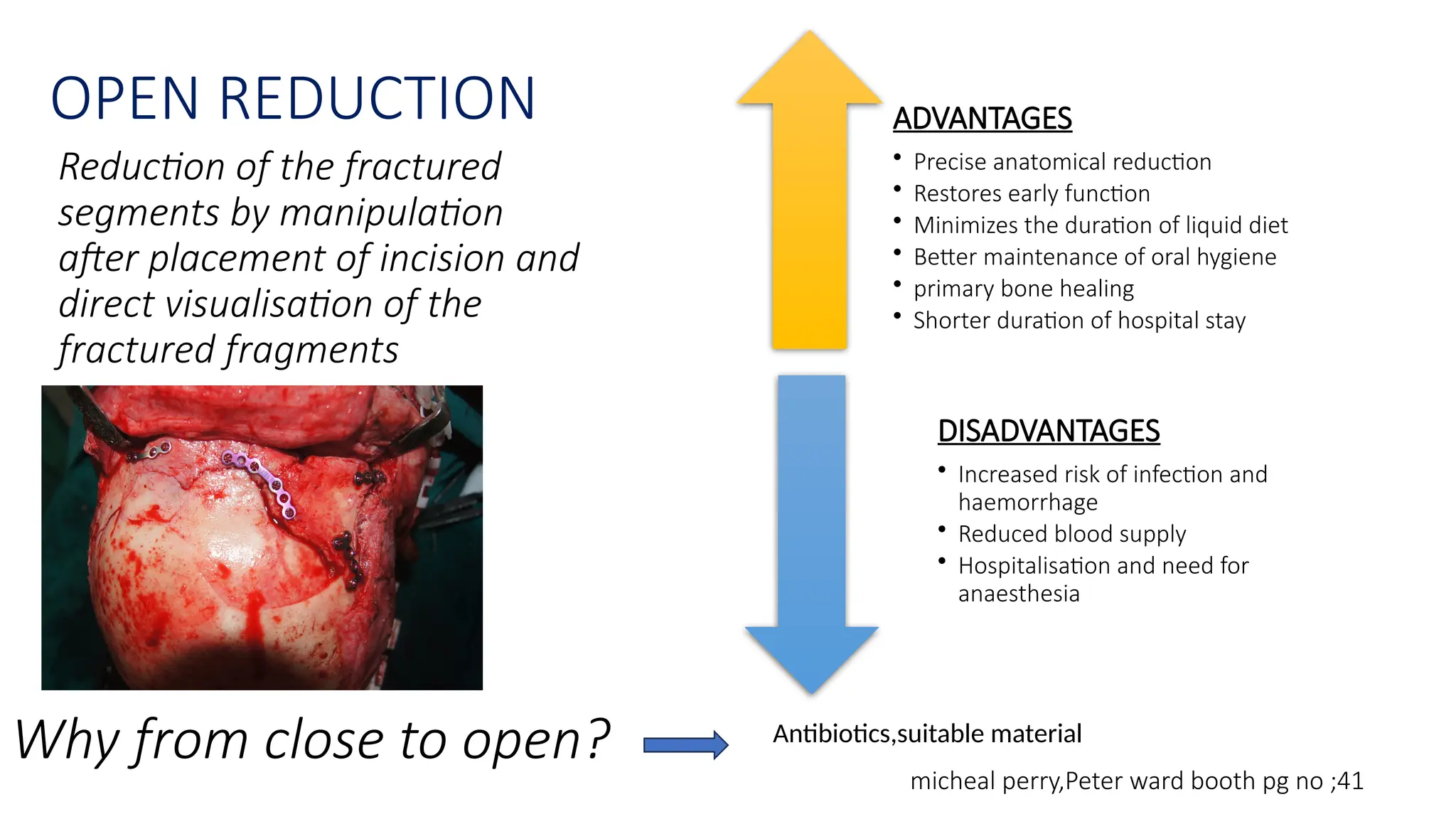 INTERNAL FIXATION IN MAXILLOFACIAL TRAUMA- PART A [Autosaved].pptx