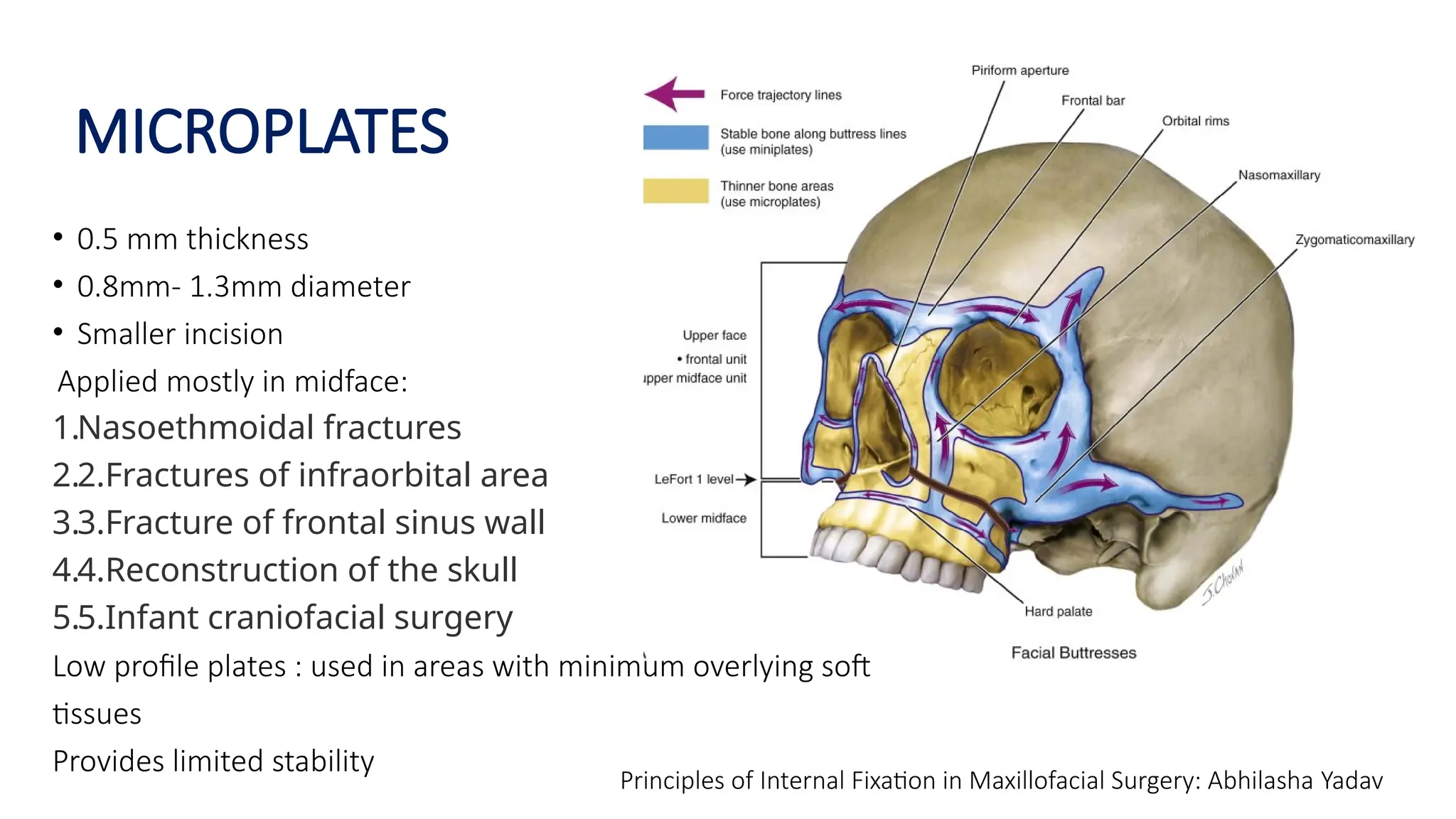 INTERNAL FIXATION IN MAXILLOFACIAL TRAUMA- PART A [Autosaved].pptx
