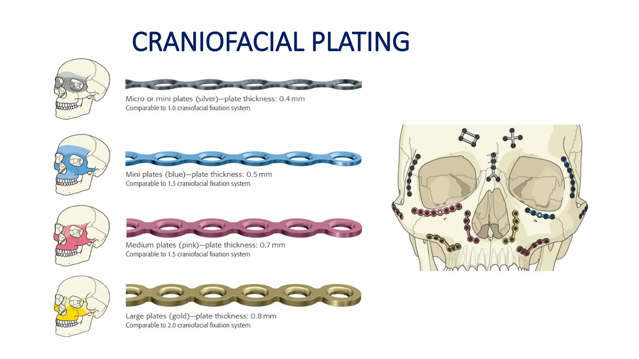 INTERNAL FIXATION IN MAXILLOFACIAL TRAUMA- PART A [Autosaved].pptx