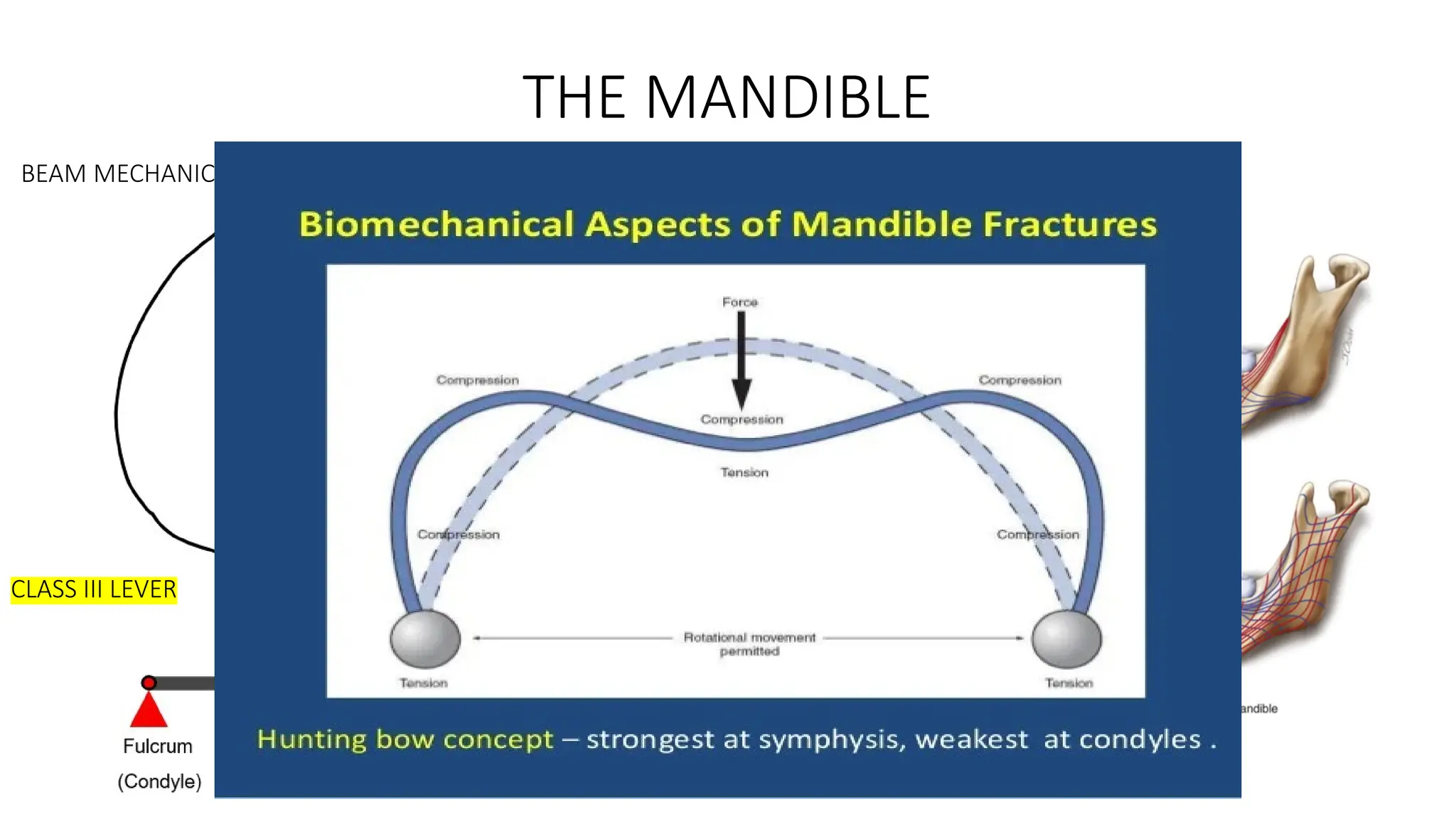 INTERNAL FIXATION IN MAXILLOFACIAL TRAUMA- PART A [Autosaved].pptx