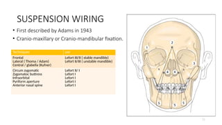 INTERNAL FIXATION IN MAXILLOFACIAL TRAUMA- PART A [Autosaved].pptx