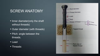 Internal fixators | PDF