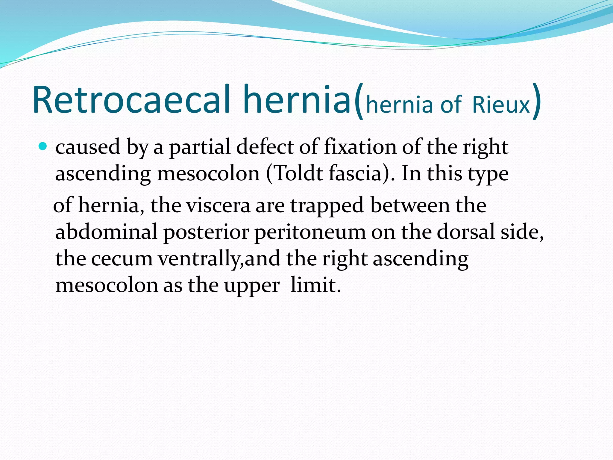 Internal hernia | PPTX