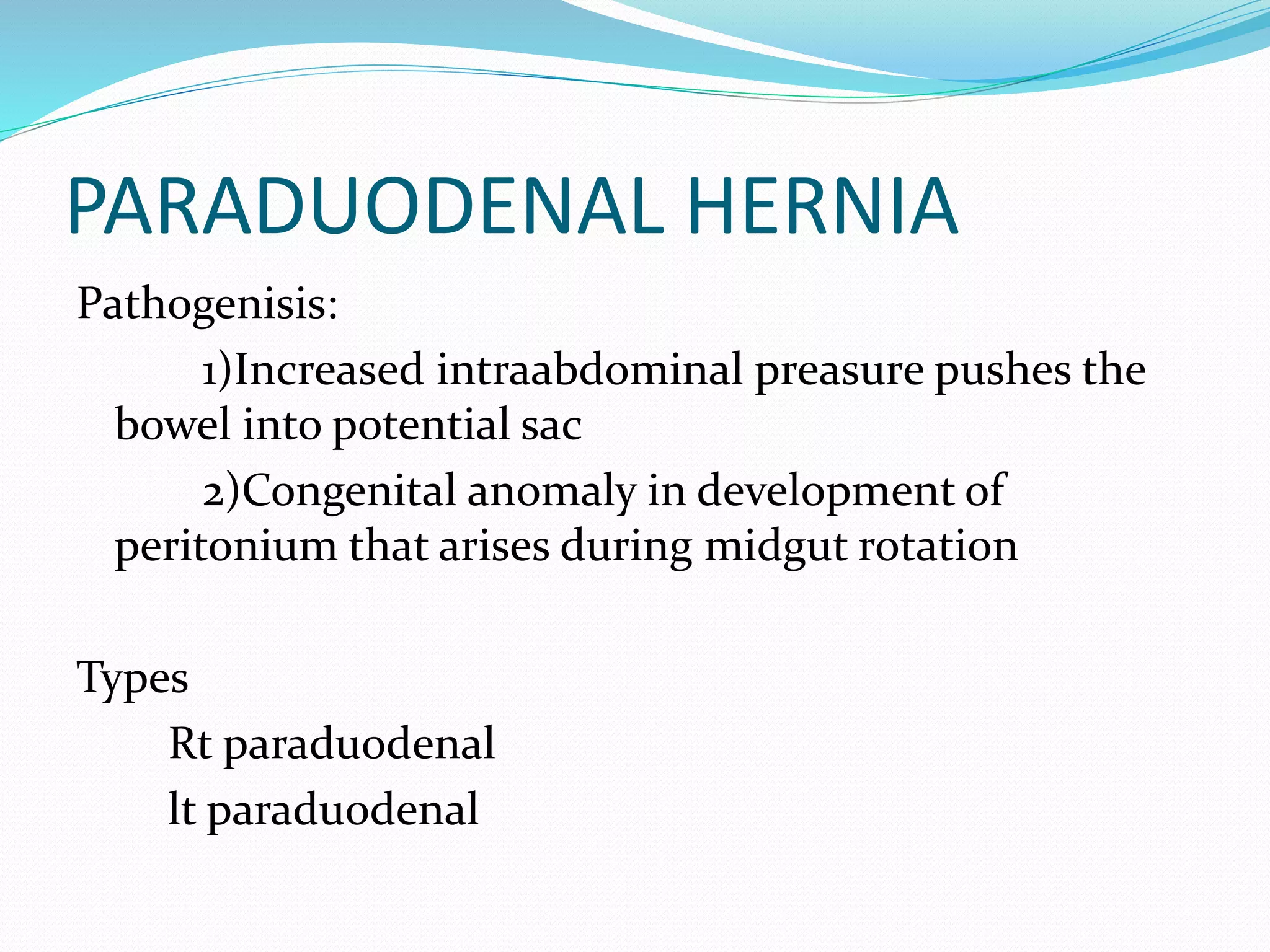 Internal hernia | PPTX