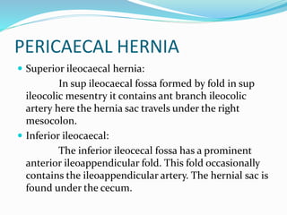 Internal hernia | PPTX
