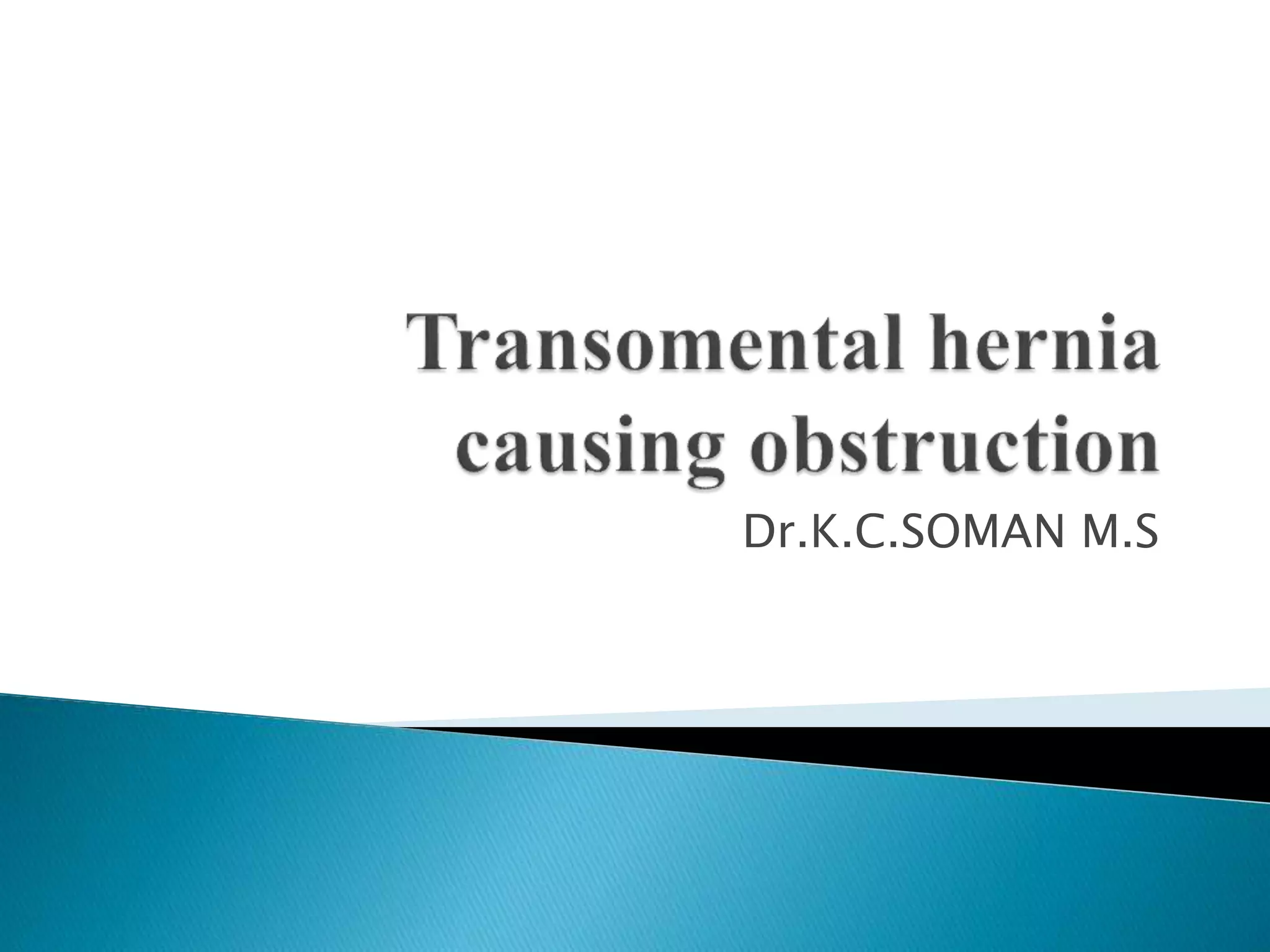 Internal hernia | PPTX