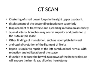 INTERNAL HERNIA of small bowel contents.pptx