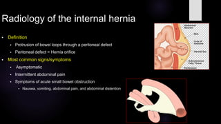 Internal hernia radiology by Dr. Abdelkarim.pdf