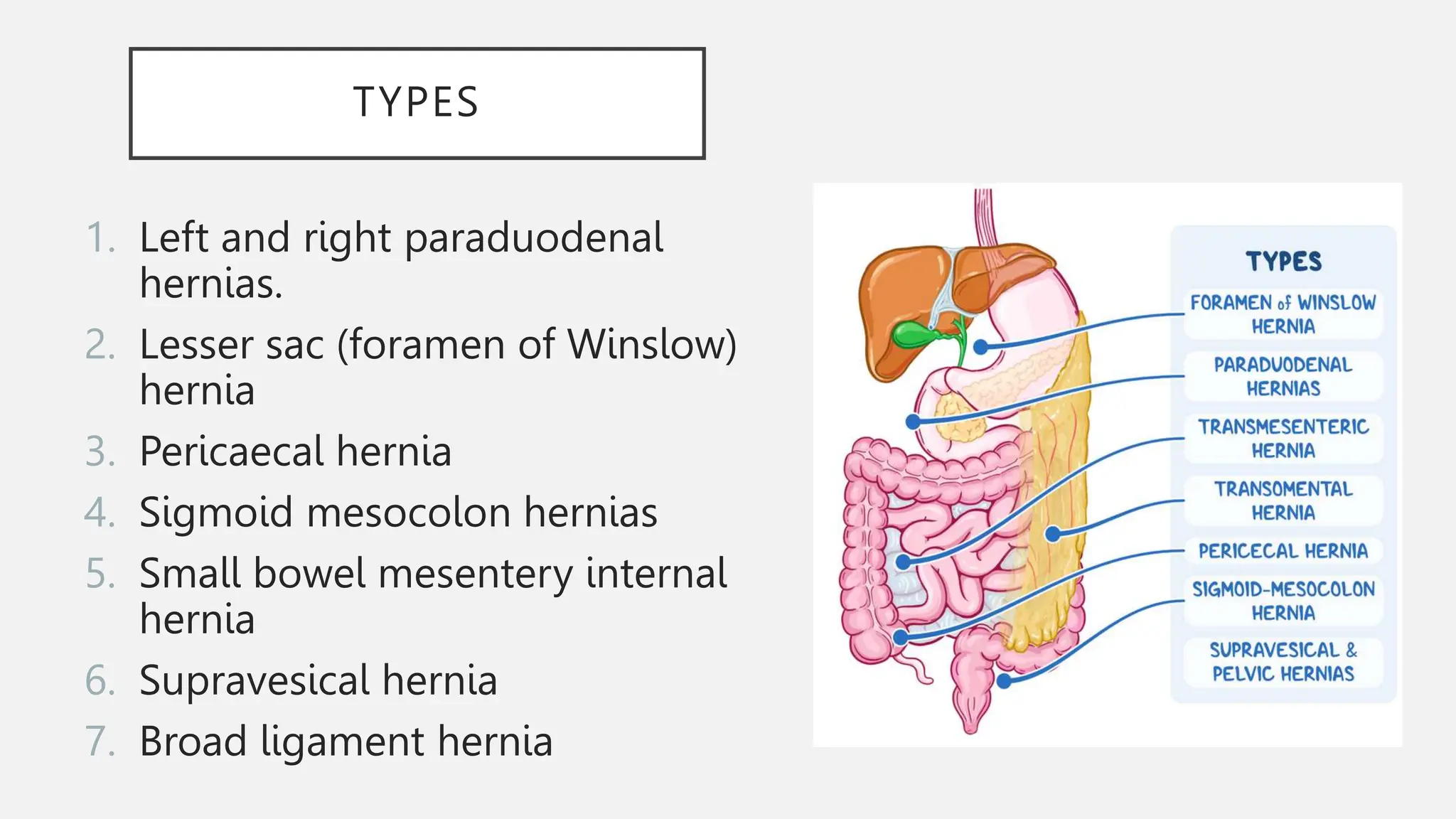 INTERNAL HERNIAS. pptx internal herniass | PPTX