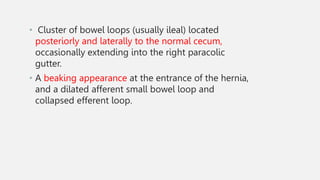 INTERNAL HERNIAS. pptx internal herniass | PPTX