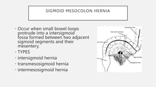 INTERNAL HERNIAS. pptx internal herniass | PPTX