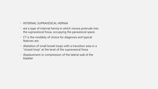 INTERNAL HERNIAS. pptx internal herniass | PPTX