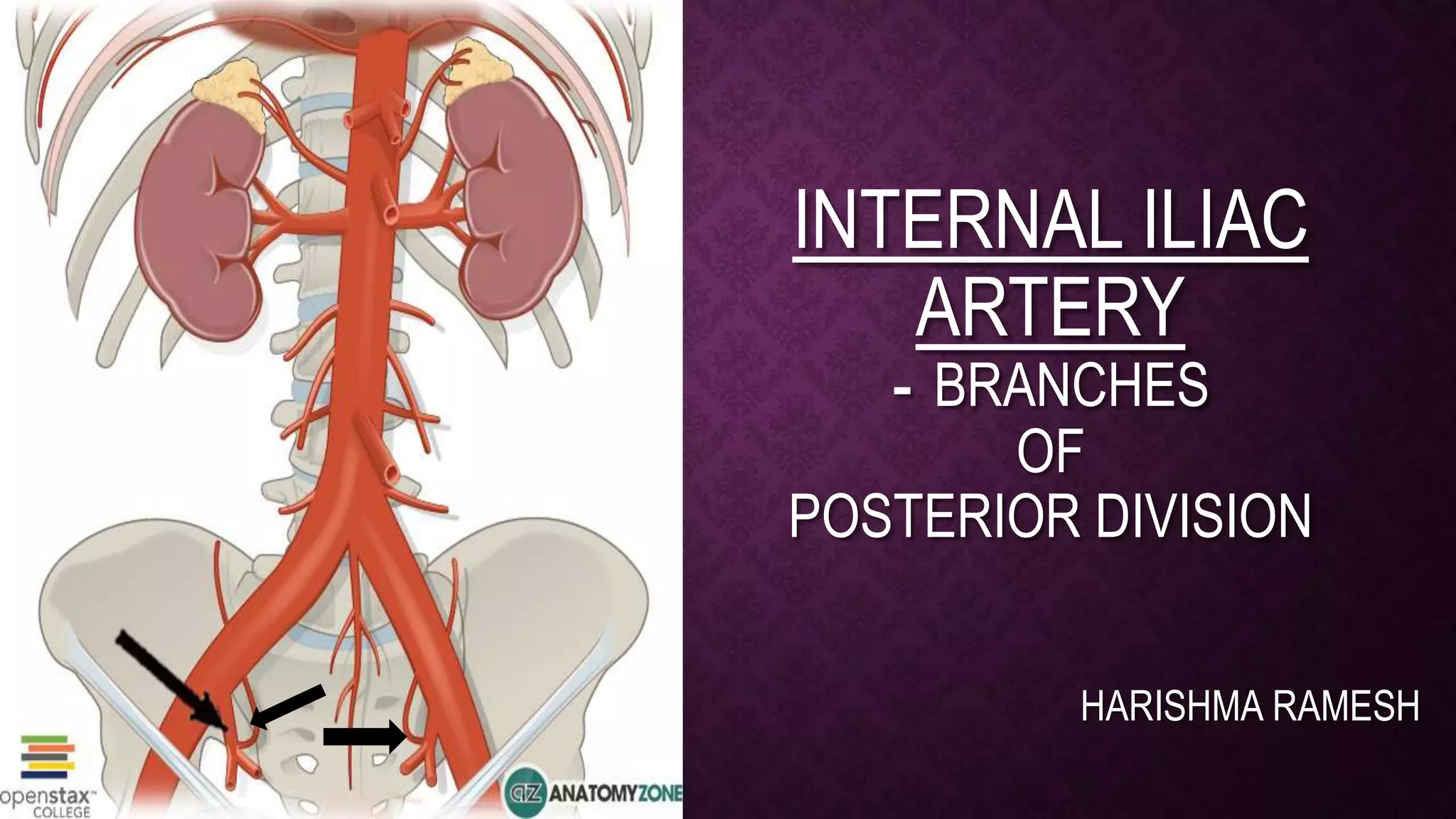 Internal iliac artery | PPTX