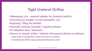 COMPLICATIONS OF URETEROSCOPY & ITS MANAGEMENT | PDF