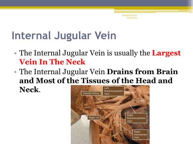 Internal Jugular Vein | PPTX