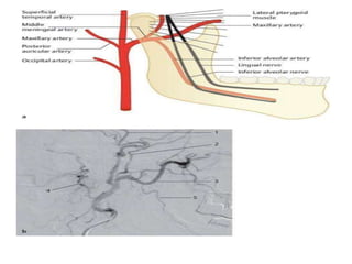 Internal maxillary artery & its branches | PPTX