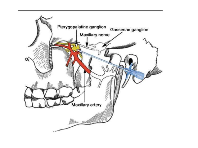 Internal maxillary artery & its branches | PPTX | Ear, Nose and Throat ...