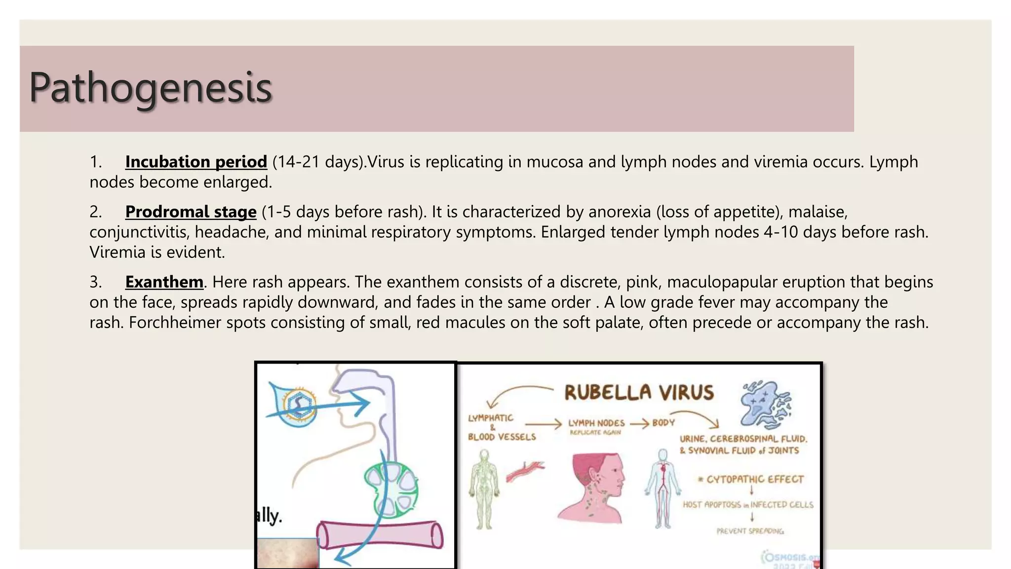 Measles and Rubella | PPTX