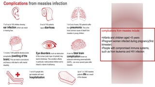 Measles and Rubella | PPT