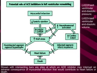 Internal Medicine Lecture 3 Acute coronary syndrome Myocardial ...