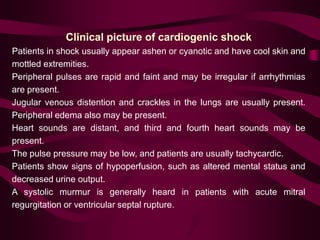 Internal Medicine Lecture 3 Acute coronary syndrome Myocardial ...