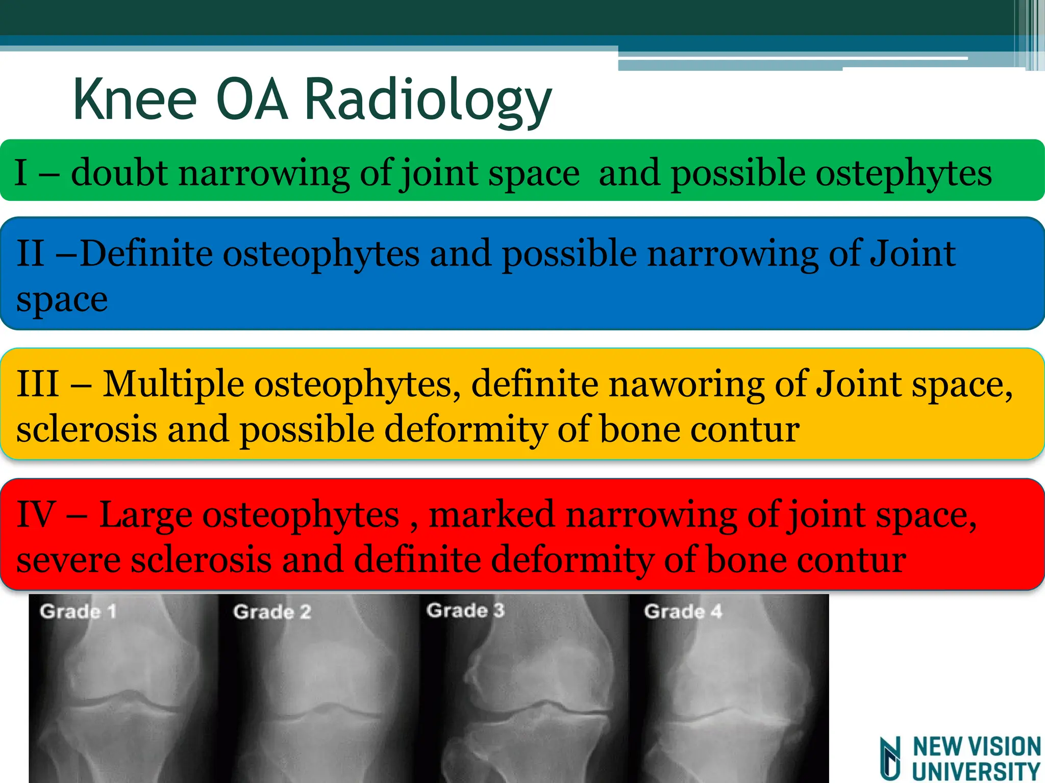 Internal Medicine Topic 9 OA and RA.pptx