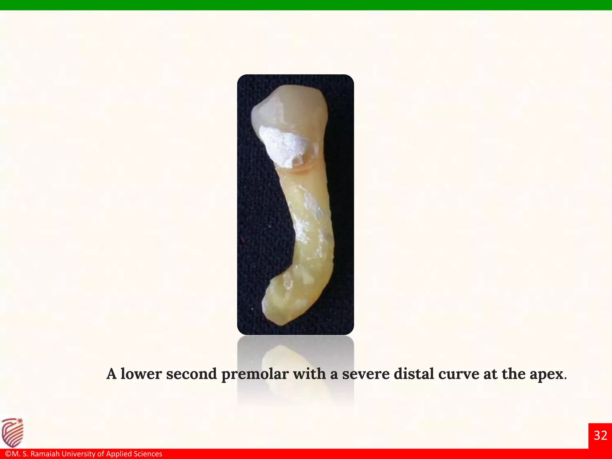 Internal morphology of permanent teeth | PPTX