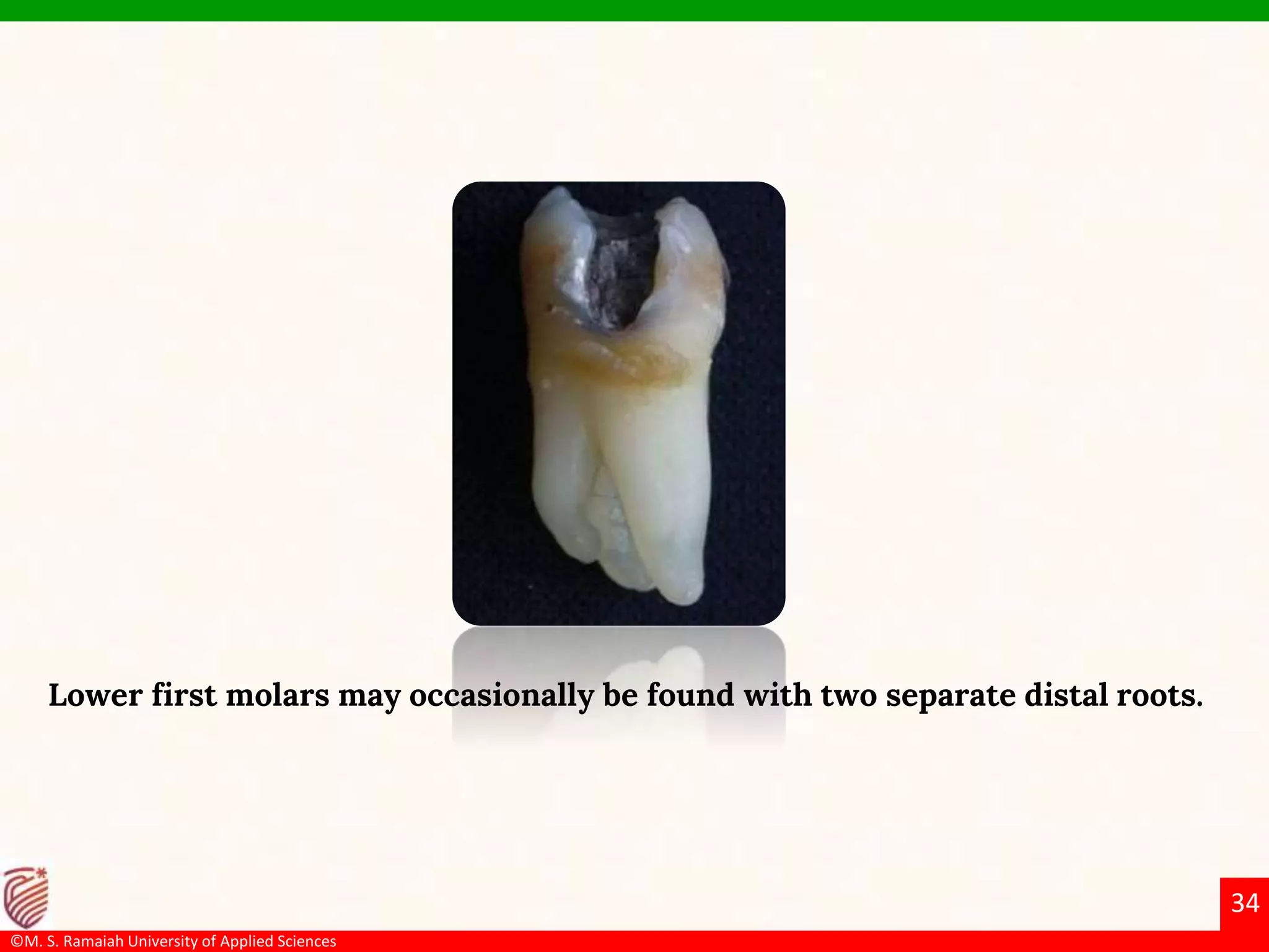 Internal morphology of permanent teeth | PPTX