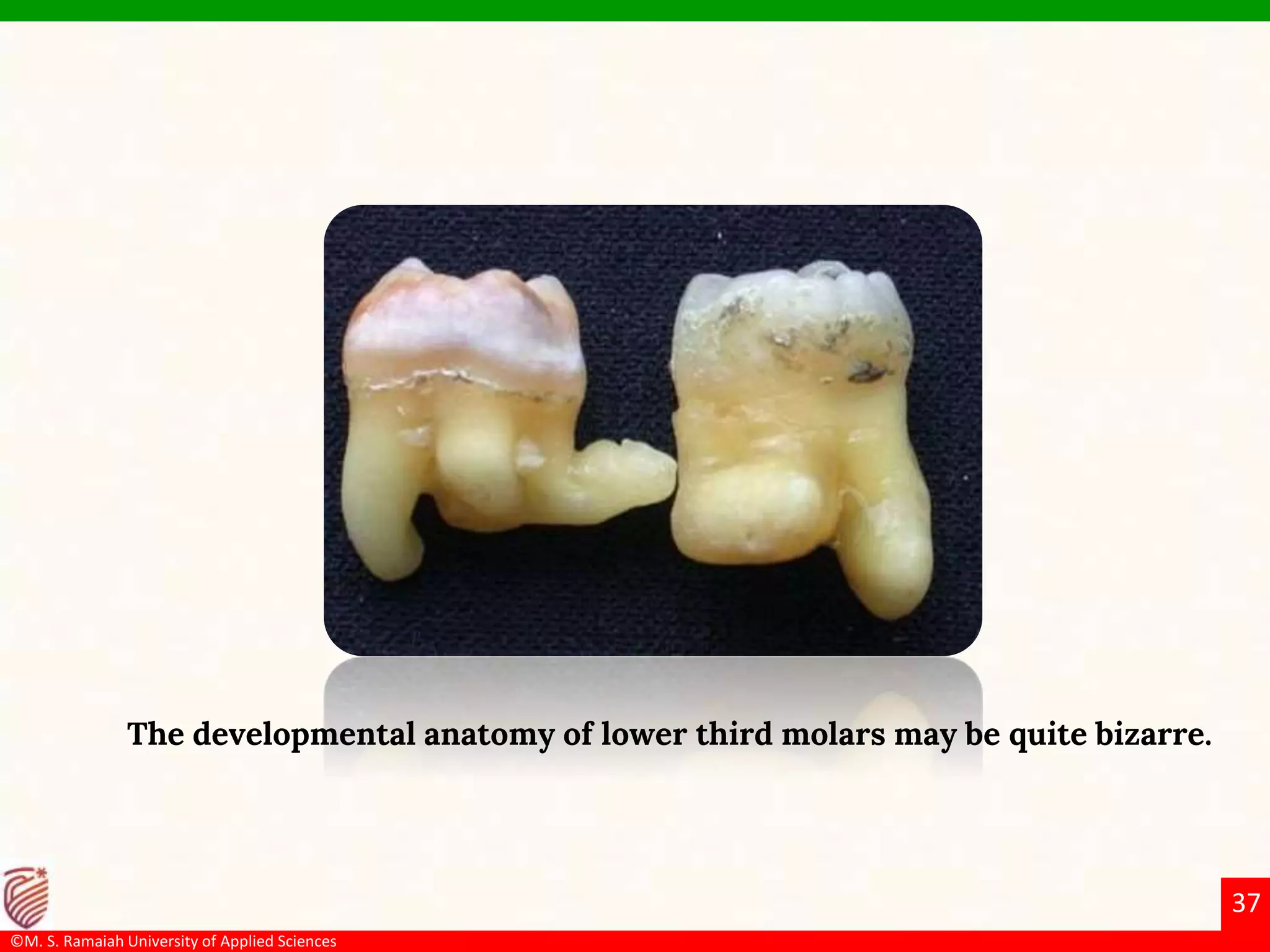 Internal morphology of permanent teeth | PPTX