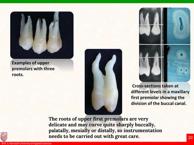 Internal morphology of permanent teeth | PPTX