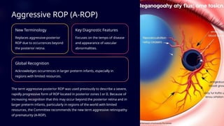 International-Classification-of-Retinopathy-of-Prematurity.pptx
